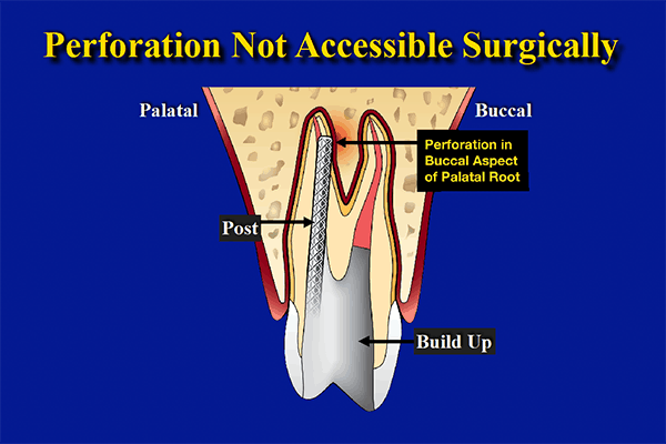 Indications for Replantation and Recommended Techniques - American ...
