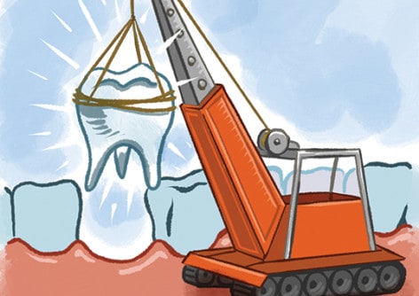 Indications for Replantation and Recommended Techniques - American ...