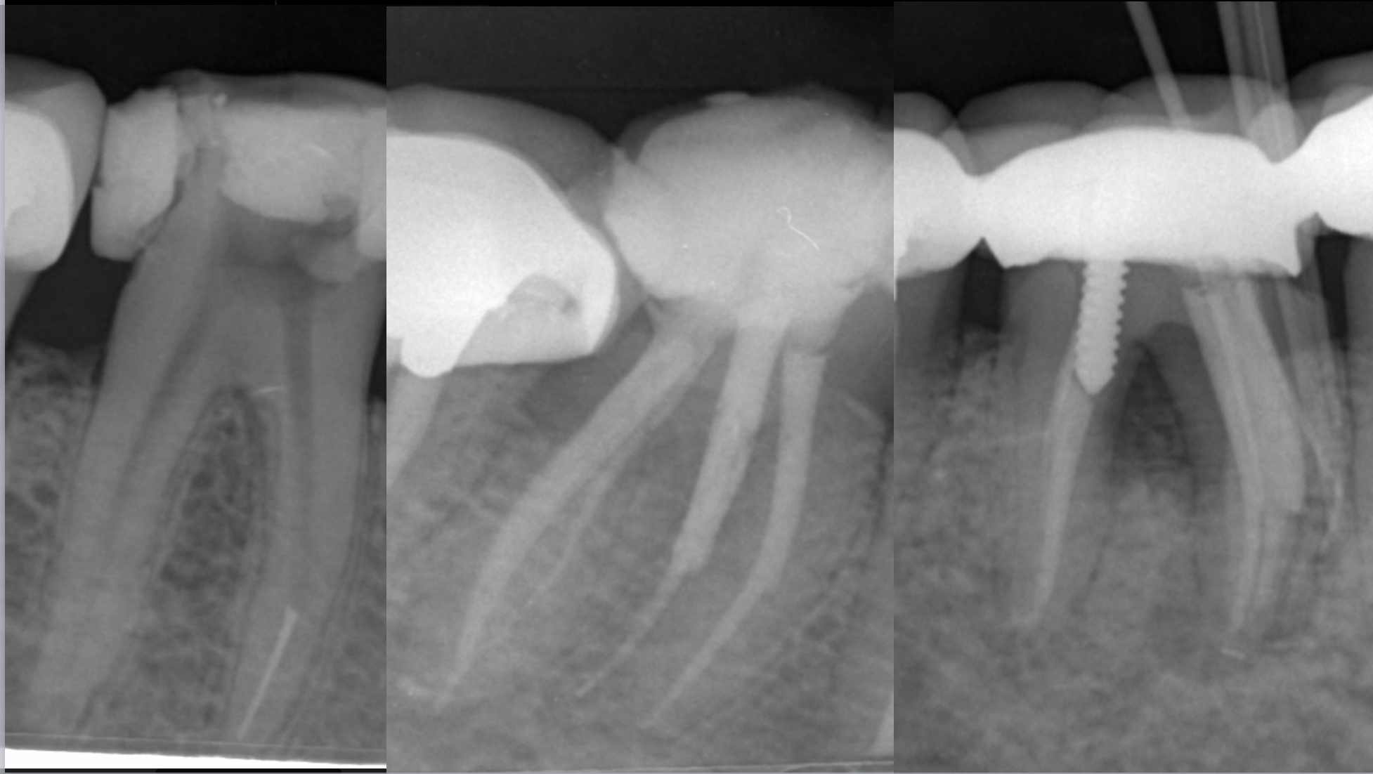 Broken Instruments - Clinical Decision Making Algorithm - American ...
