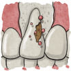 Differentiating Resorption - American Association of Endodontists