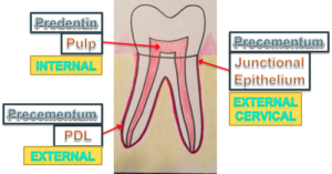 Differentiating Resorption - American Association of Endodontists