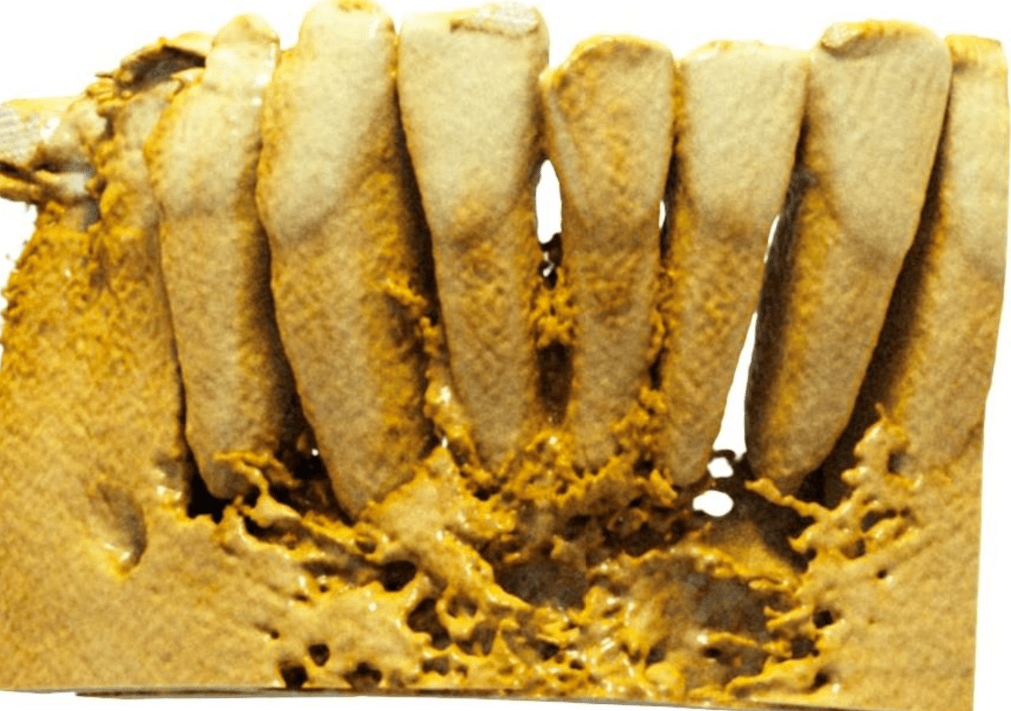 Save a Tooth, Maybe Save a Life - American Association of Endodontists