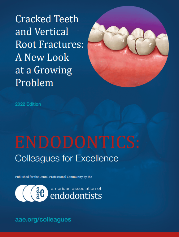 Endodontists - Root Canal Specialist | AAE