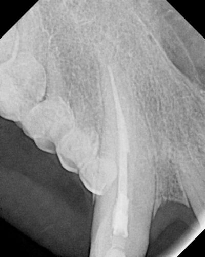 Postop radiograph Photo 9 - American Association of Endodontists