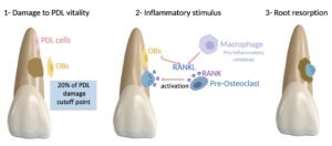 Cell-Based PDL Regeneration for the Management of Avulsed Teeth ...