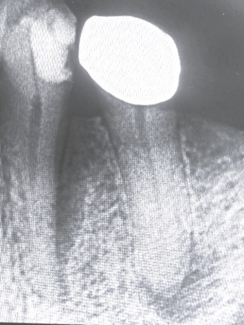 Endodontic and Periodontic Dilemmas: Bridging the Diagnostic Divide ...
