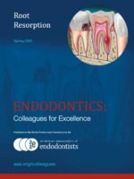 Root Resorption - American Association of Endodontists