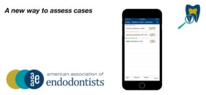 Case Assessment Tools - American Association of Endodontists